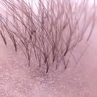 Knotless Ventilating Techniques On Skin Hair Systems - New Times Hair