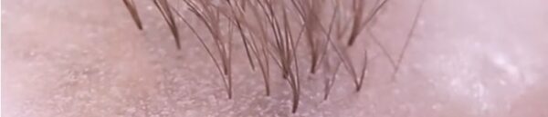 Knotless Ventilating Techniques On Skin Hair Systems - New Times Hair