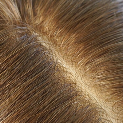 Natural Ventilation Makes Natural Hair Replacement Systems