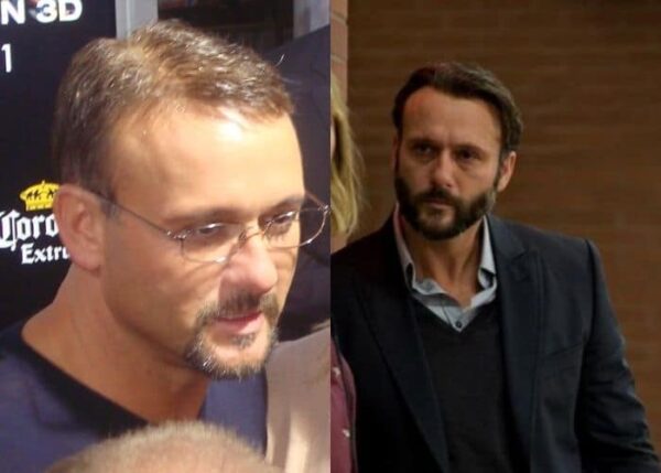 Male Celebrities Who Wear Toupees and Wigs Due to Hair Loss