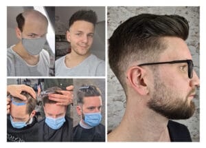 Wholesale Toupee Supplier | Hair System Manufacturer-New Times Hair