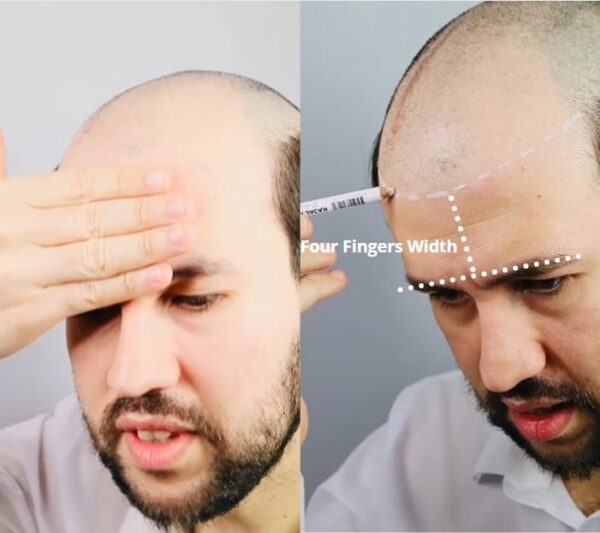 Men's Hair Piece Installation|Hair System Installation Free Course