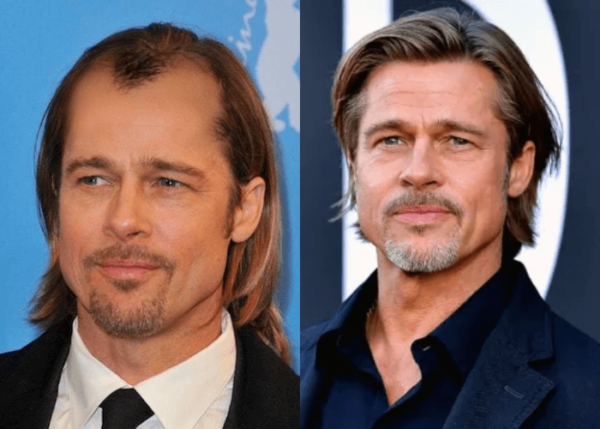 23 Famous Wig Wearers: Celebrities with Toupees & Wigs