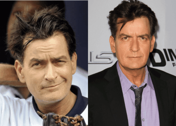 Male Celebrities Who Wear Toupees and Wigs Due to Hair Loss