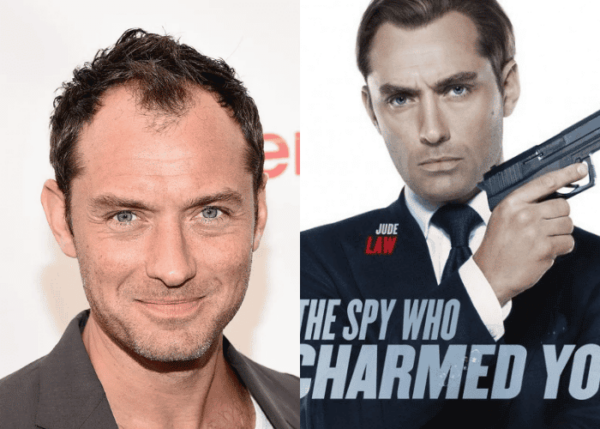 Male Celebrities Who Wear Toupees and Wigs Due to Hair Loss