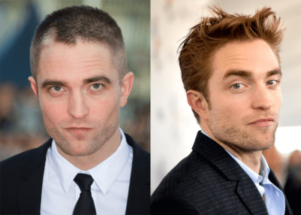 Male Celebrities Who Wear Toupees and Wigs Due to Hair Loss