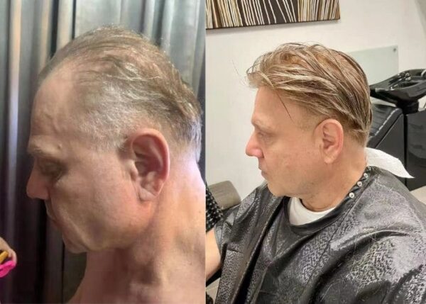 What’s the Fuss About Ted Danson’s Hair?