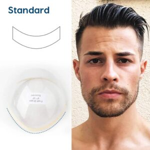 Front Contour Shape Samples of Hair Systems | New Times Hair