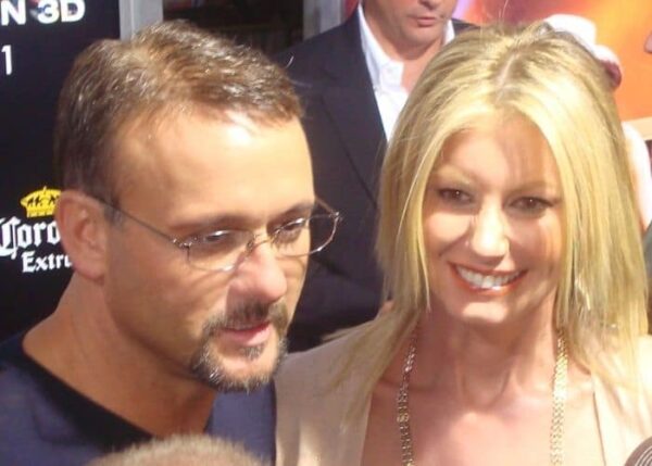 Is Tim McGraw Bald? Does He Wear A Toupee Wig?