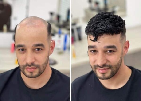 20 Trendiest Toupee Haircuts to Try in 2025