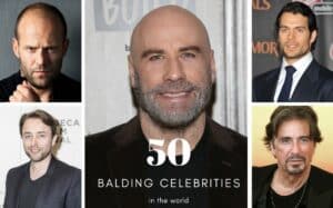 50 Balding Celebrities from the Famous Bald People Club