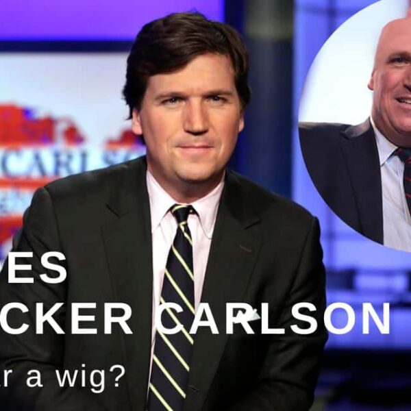 Does Bill Self Wear a Toupee