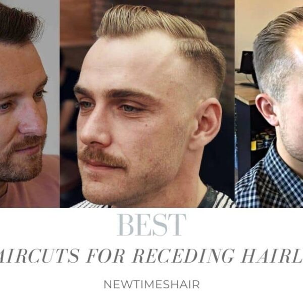 How to Fix Receding Hairline