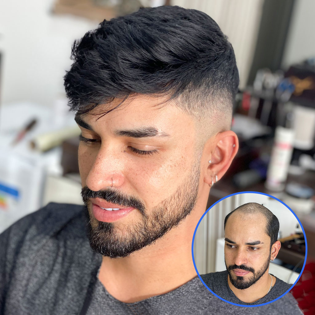 New 0.08mm Thin Skin Hair System for Men | Tailored Hairline