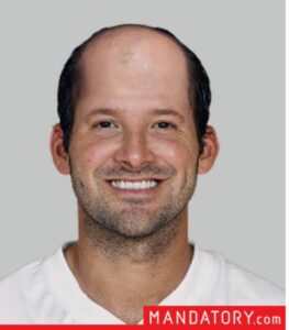 Is Tony Romo Bald or Wearing a Hair Piece?