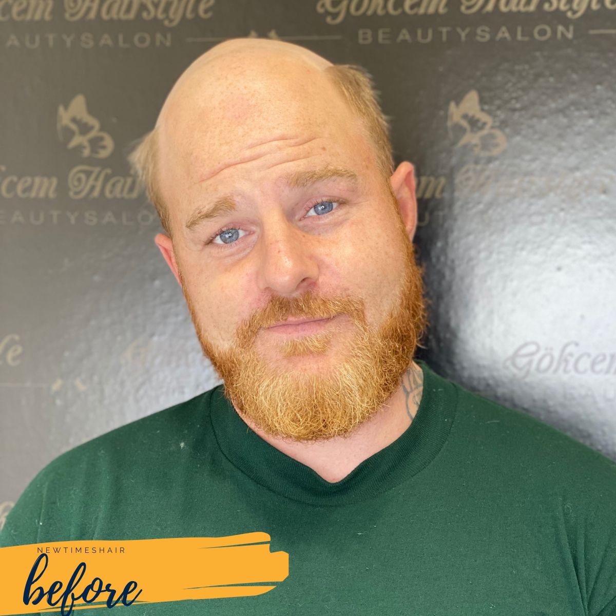 Best Men's Toupees that Gives You a Perfect Head of Hair