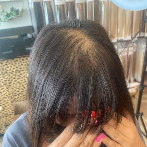 Best Wigs and Toppers for Alopecia and Women's Hair Loss