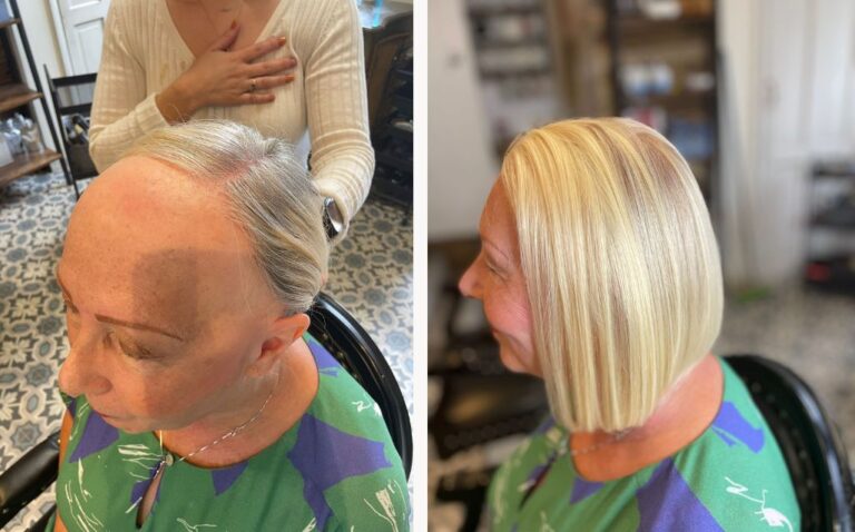 Hair Loss Hairstyles for Thinning Hair on Crown With Hair Systems