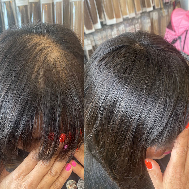 Hair Toppers Before and After