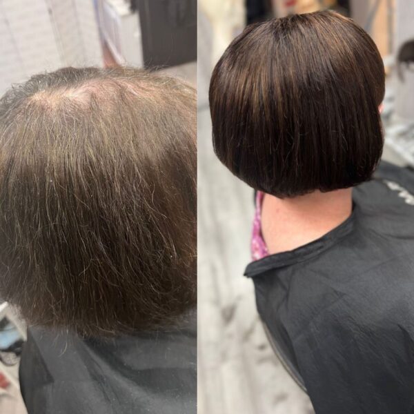 Hair Integration System Tutorial and Our Top Five Products