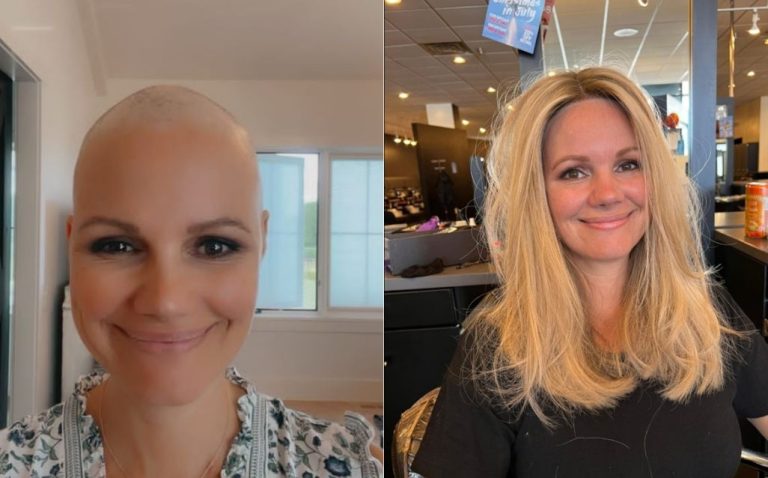 Hair Loss Hairstyles for Thinning Hair on Crown With Hair Systems