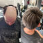 Hair Systems Before and After | Toupee Hairstyle
