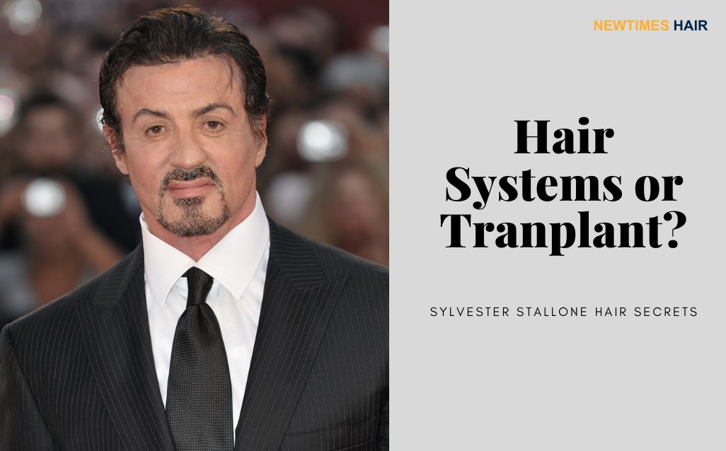 Sylvester Stallone Hair Secrets: a Toupee or Transplant?