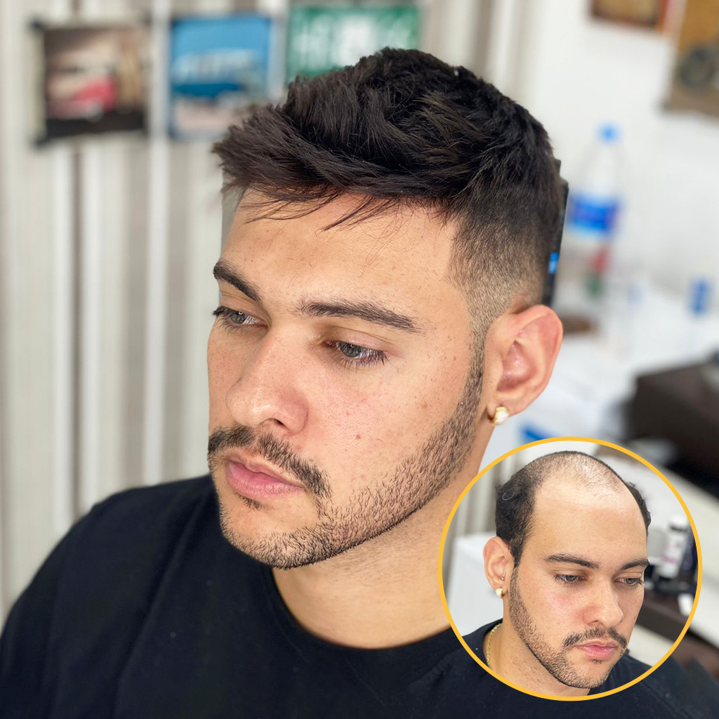 VIVI-HW Durable Mono Hair System Base With A PU Perimeter