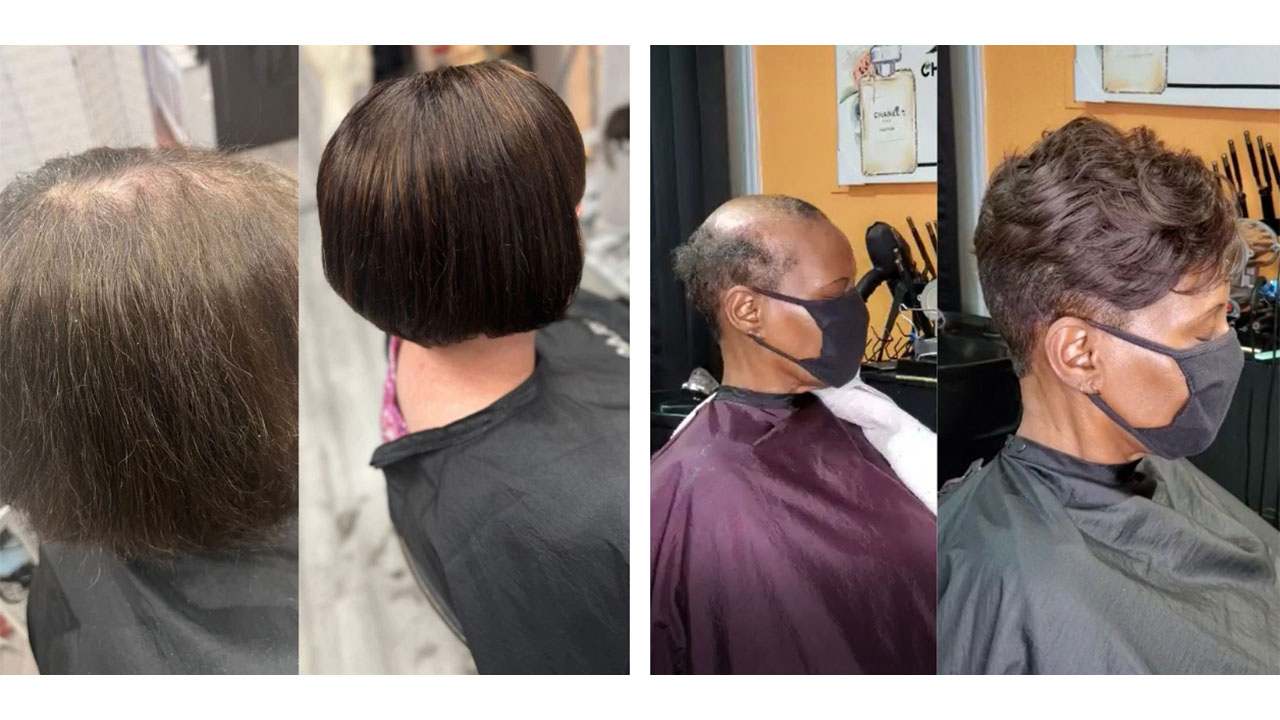 What Is A Hair Topper? Everything You Need to Know