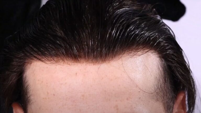 What Is a Toupee? A Guide & Newtimes Hair's 10 Best Toupees