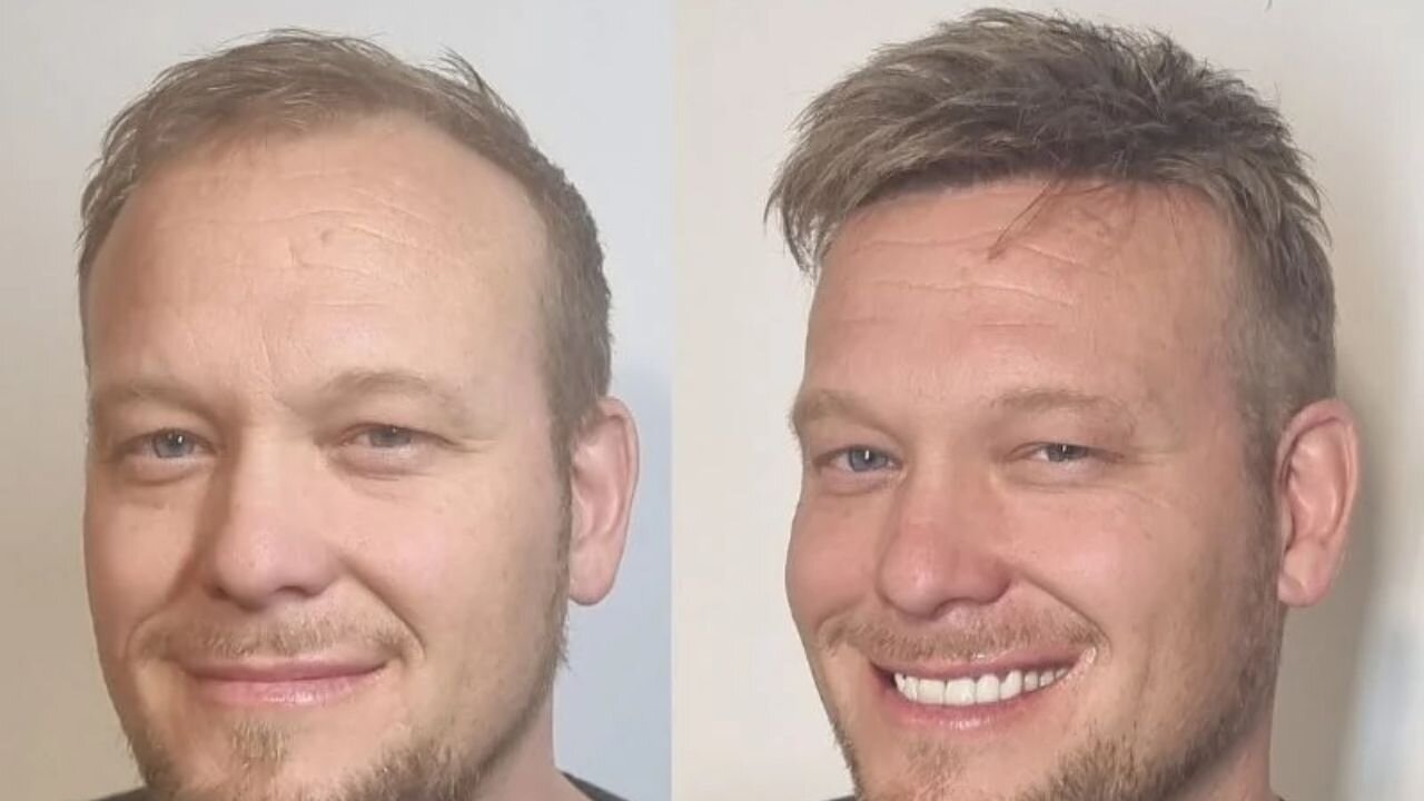 What Is a Toupee? A Guide & Newtimes Hair's 10 Best Toupees