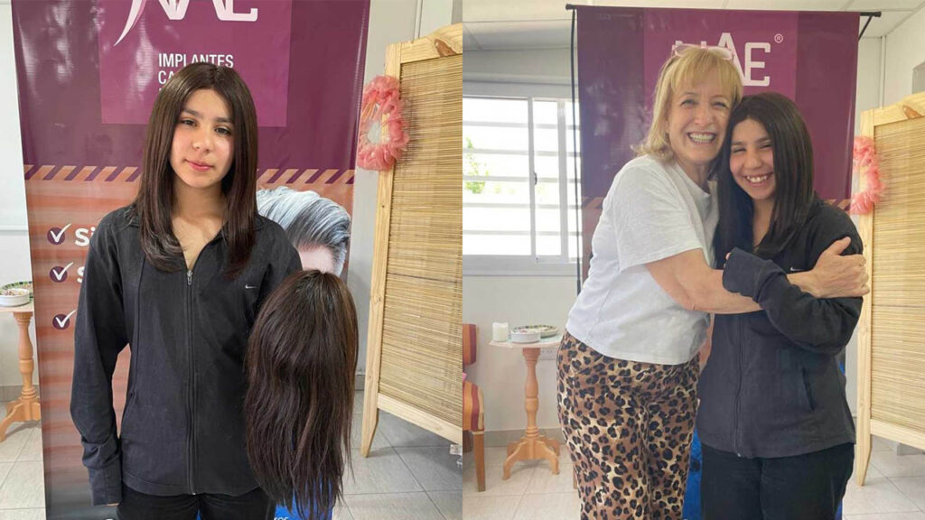 Newtimes Hair Medical Wigs Transform Lives | A Testimony
